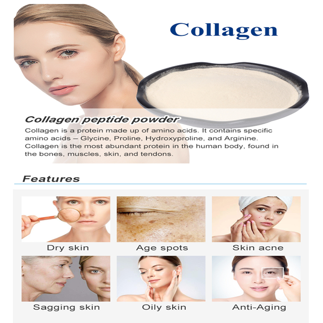 China OEM Supply Bovine Bone Collagen Peptide Food Grade Hydrolyzed ...